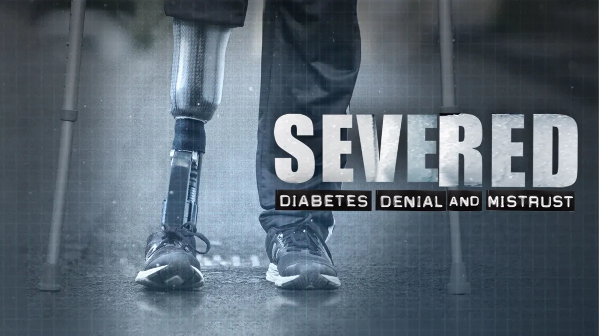 Watch Severed: Diabetes Denial and Mistrust | Full Episodes | Disney+